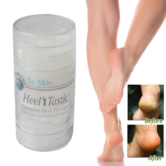 Cracked Heels Lotion | Walmart Canada