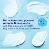 Clean & Clear Persa-Gel 5 Oil-Free Acne Spot Treatment with Maximum ...