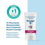 Crosssmark & Select Brand Distributors Inc Benzagel Acne Care Gel, 60 g ...